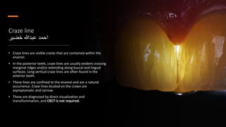 CBCT in dental trauma__.pptx explain dental trauma in cbct | PPTX