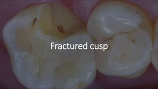 CBCT in dental trauma__.pptx explain dental trauma in cbct | PPTX