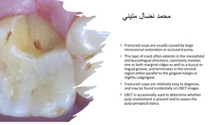 CBCT in dental trauma__.pptx explain dental trauma in cbct | PPTX