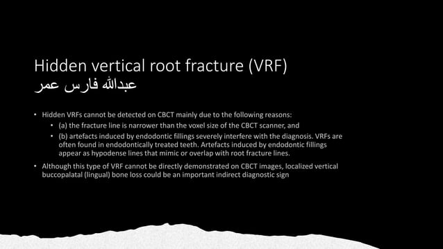 CBCT in dental trauma__.pptx explain dental trauma in cbct | PPT