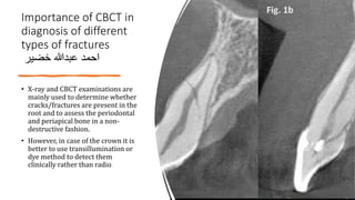 CBCT in dental trauma__.pptx explain dental trauma in cbct | PPTX
