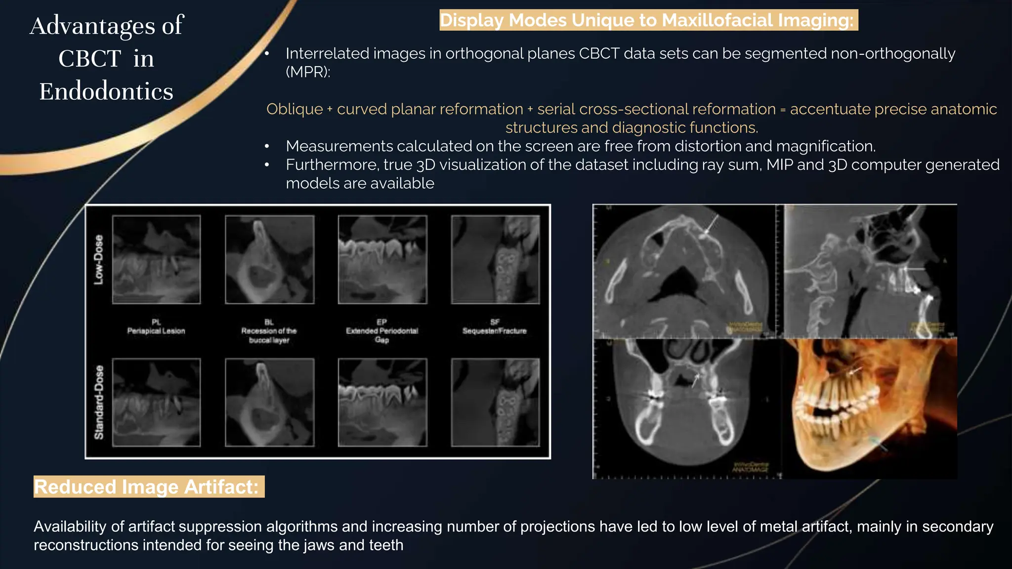 CBCT in Endodontics, Uses, Advanatges, Disadvantages, and Recent Advancements.pptx