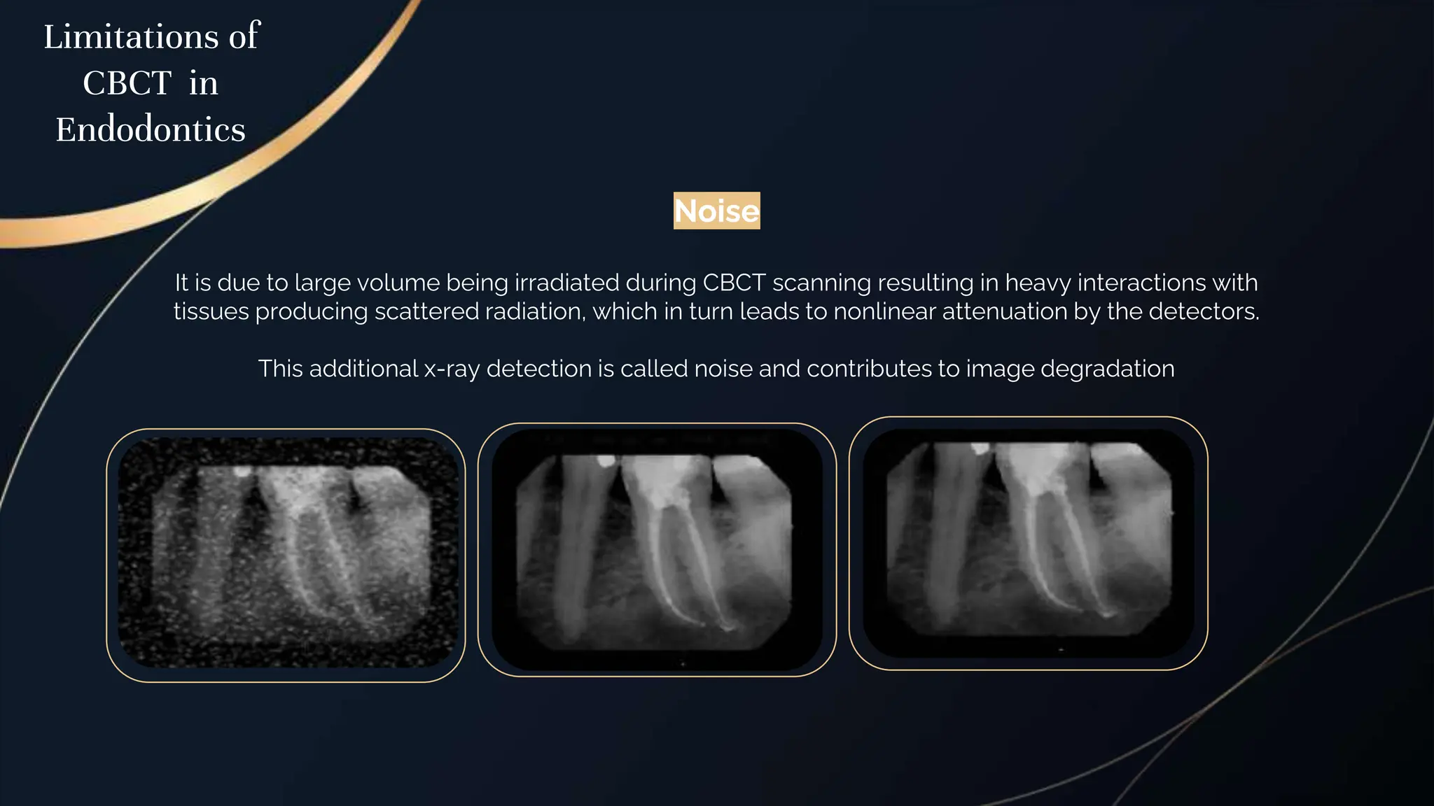 CBCT in Endodontics, Uses, Advanatges, Disadvantages, and Recent Advancements.pptx