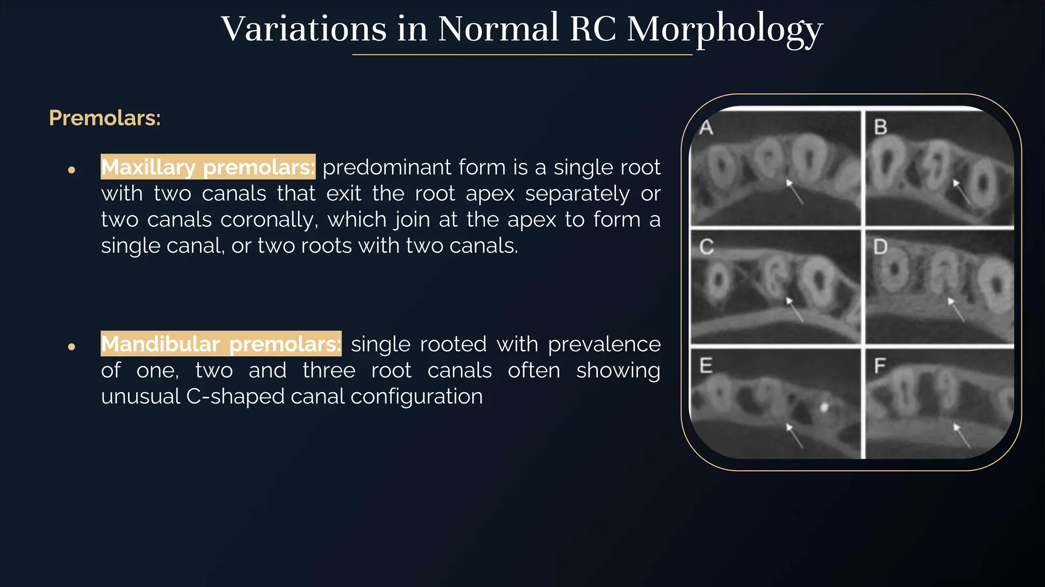 CBCT in Endodontics, Uses, Advanatges, Disadvantages, and Recent Advancements.pptx | Dental ...