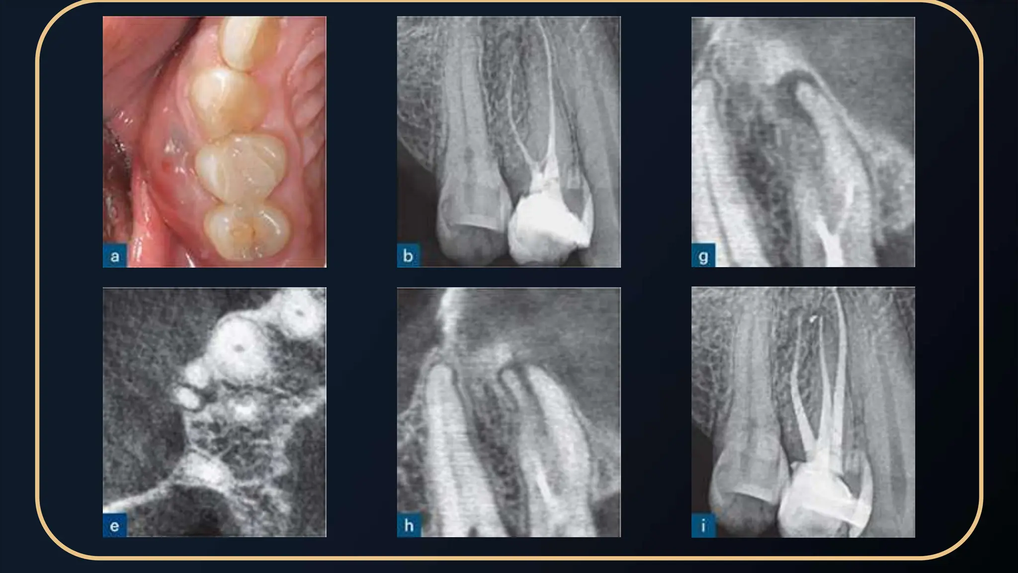 CBCT in Endodontics, Uses, Advanatges, Disadvantages, and Recent Advancements.pptx | Dental ...