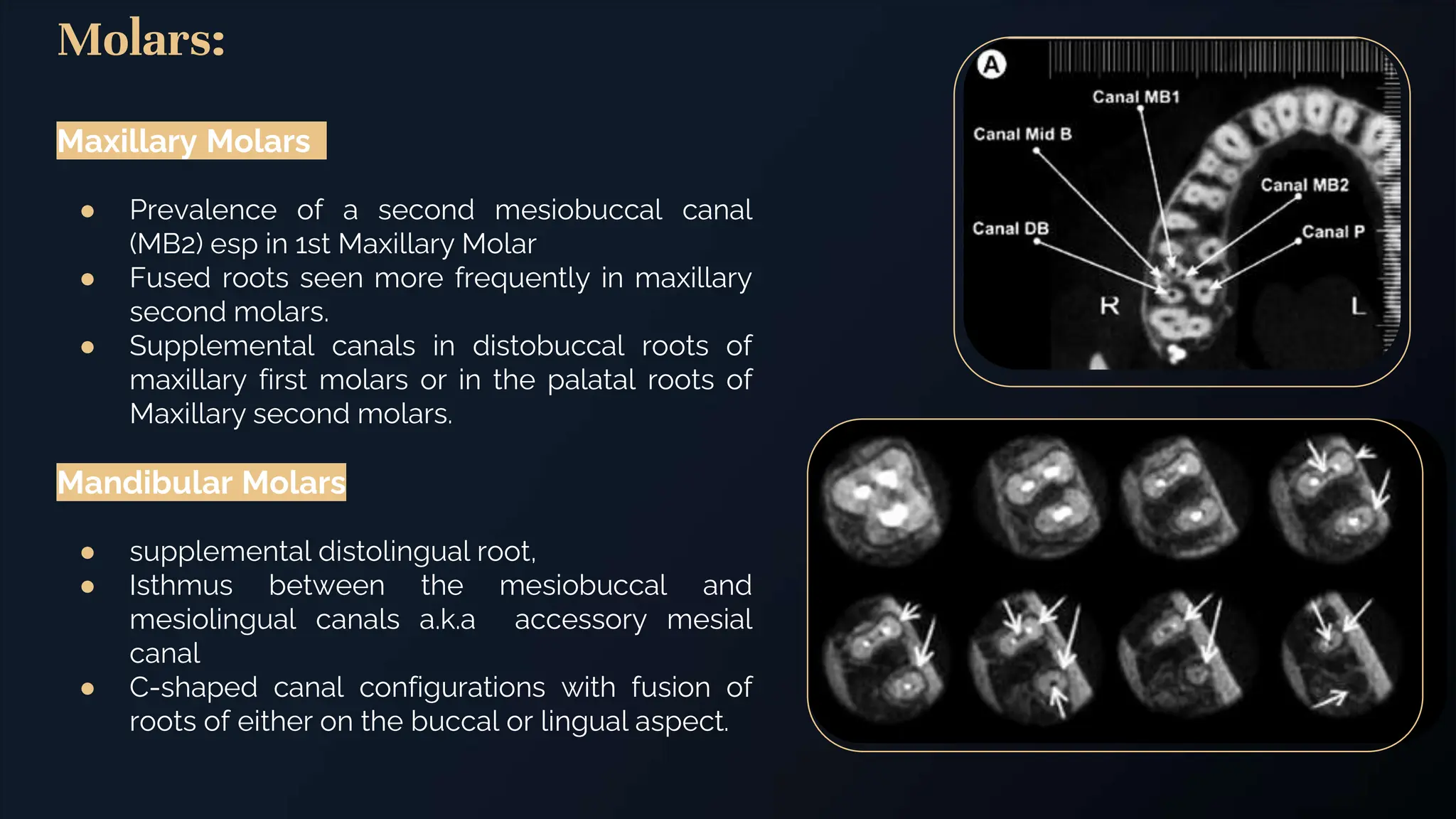 CBCT in Endodontics, Uses, Advanatges, Disadvantages, and Recent Advancements.pptx | Dental ...