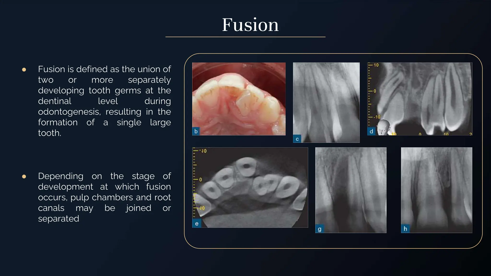 CBCT in Endodontics, Uses, Advanatges, Disadvantages, and Recent Advancements.pptx | Dental ...
