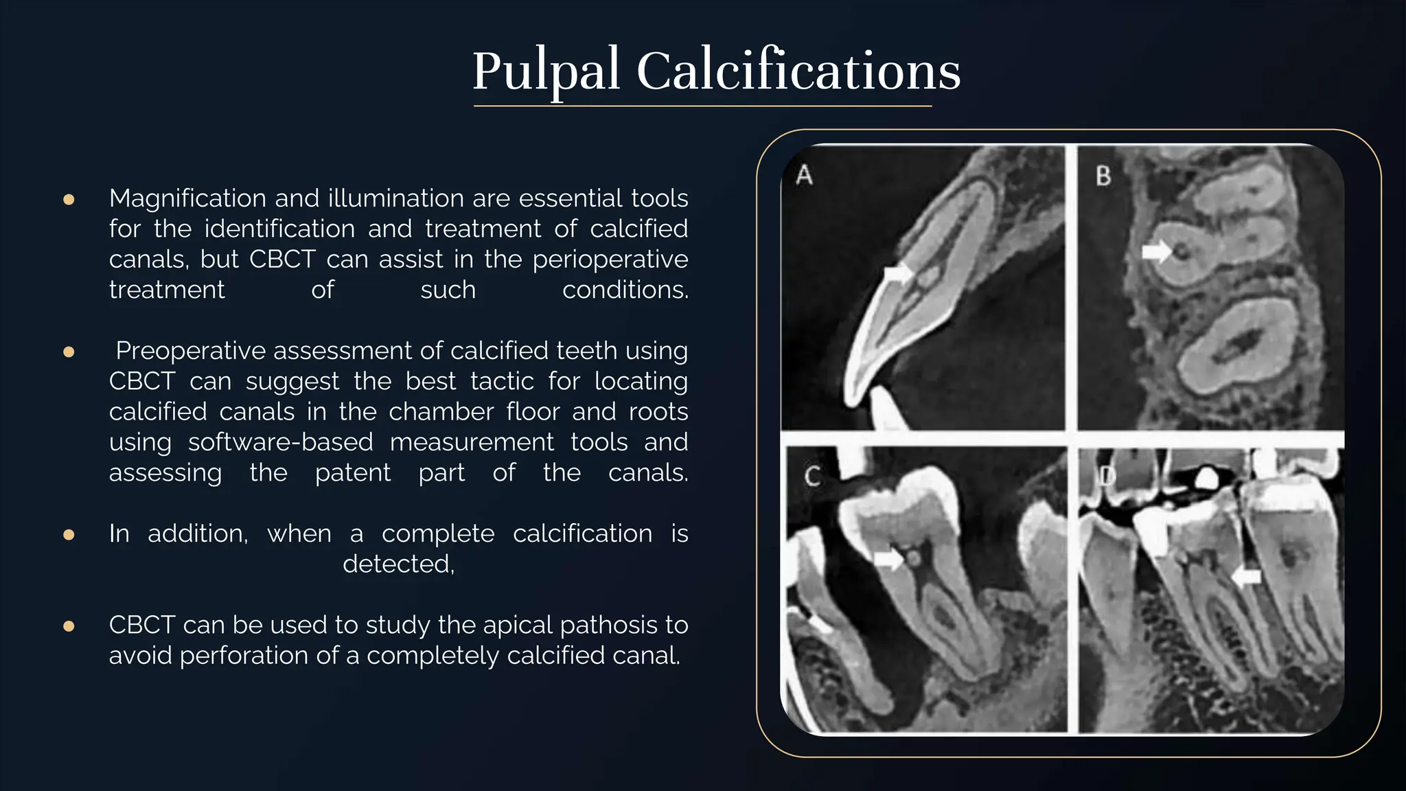 CBCT in Endodontics, Uses, Advanatges, Disadvantages, and Recent Advancements.pptx | Dental ...