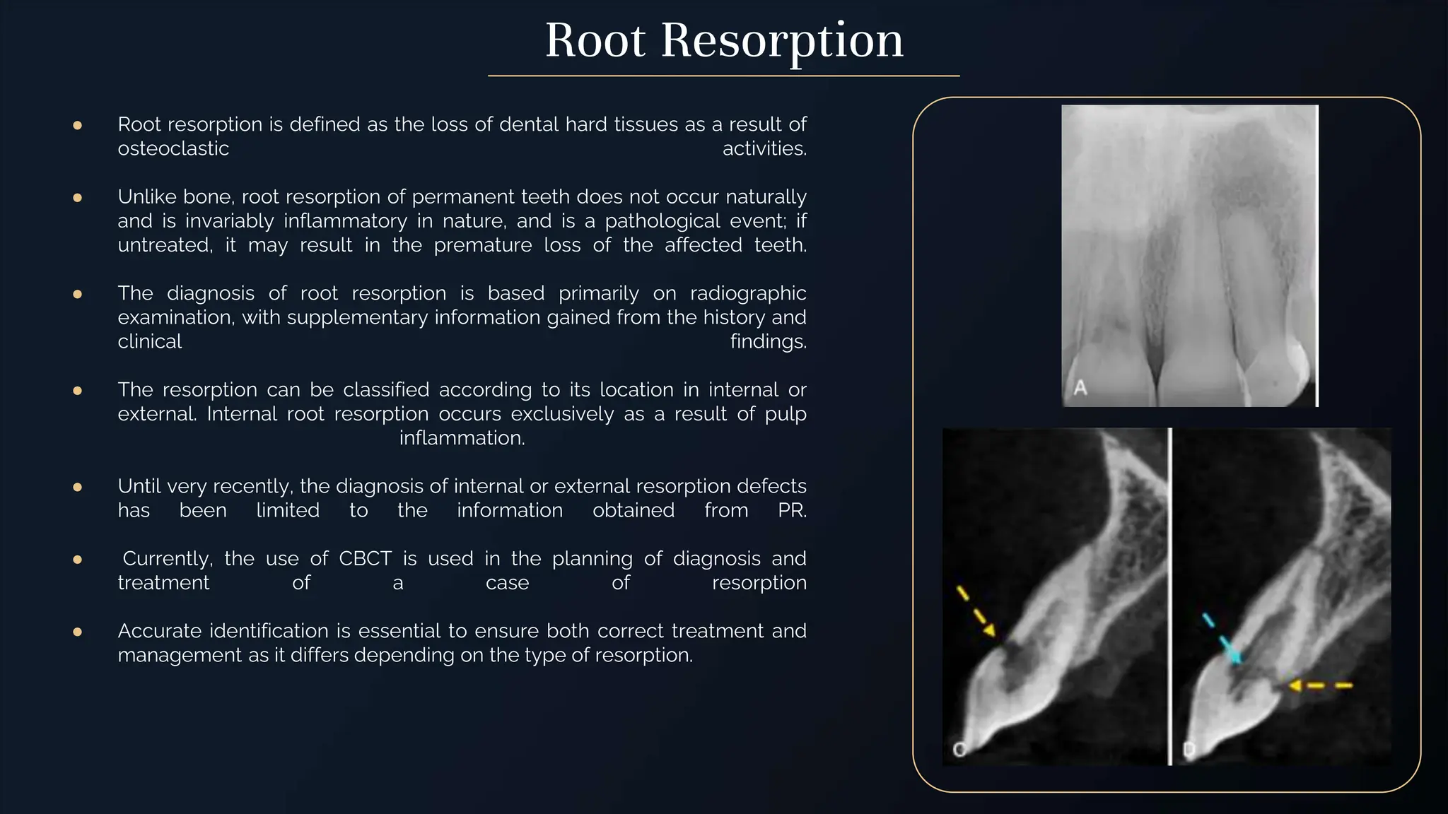 CBCT in Endodontics, Uses, Advanatges, Disadvantages, and Recent Advancements.pptx | Dental ...