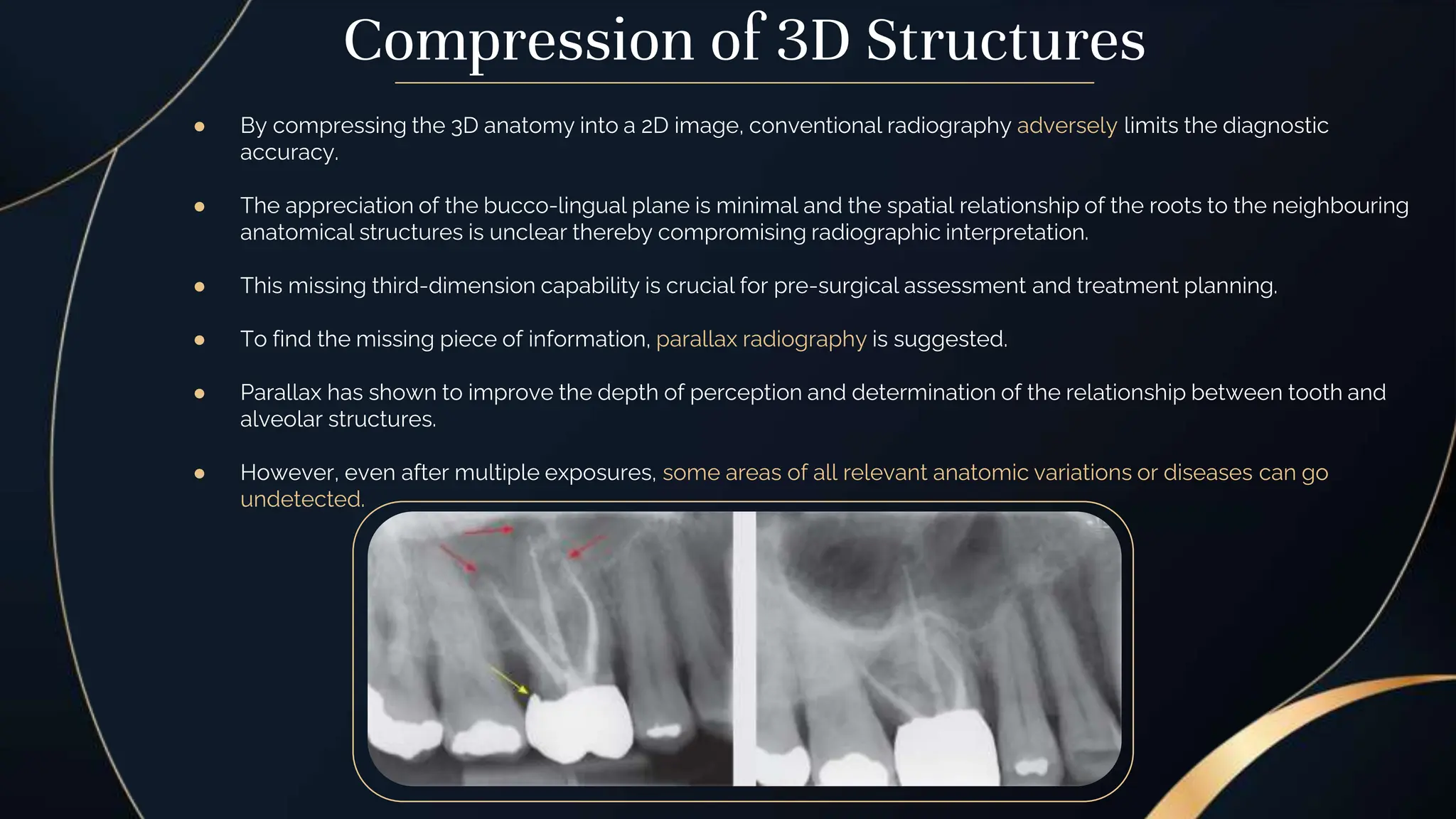 CBCT in Endodontics, Uses, Advanatges, Disadvantages, and Recent Advancements.pptx