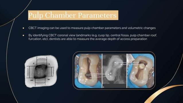CBCT in Endodontics, Uses, Advanatges, Disadvantages, and Recent Advancements.pptx | Dental ...