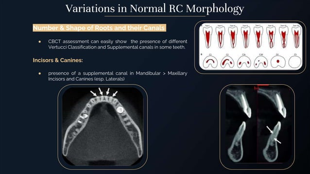 CBCT in Endodontics, Uses, Advanatges, Disadvantages, and Recent Advancements.pptx | Dental ...