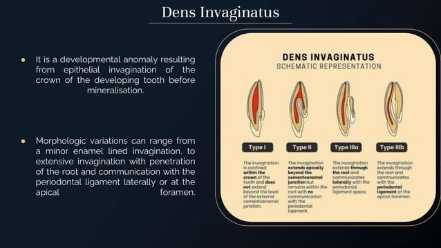 CBCT in Endodontics, Uses, Advanatges, Disadvantages, and Recent Advancements.pptx | Dental ...
