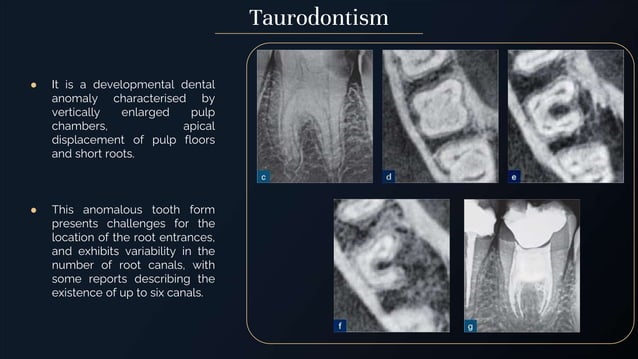 CBCT in Endodontics, Uses, Advanatges, Disadvantages, and Recent Advancements.pptx | Dental ...