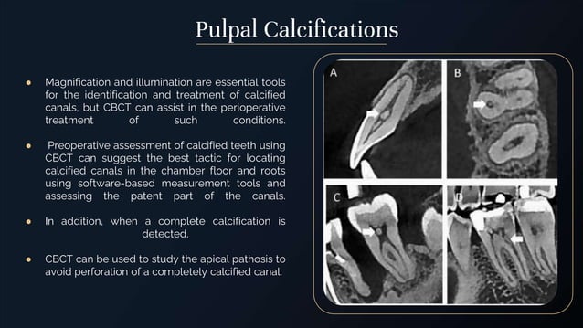 CBCT in Endodontics, Uses, Advanatges, Disadvantages, and Recent ...