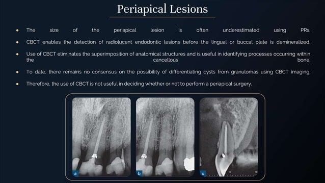 CBCT in Endodontics, Uses, Advanatges, Disadvantages, and Recent ...