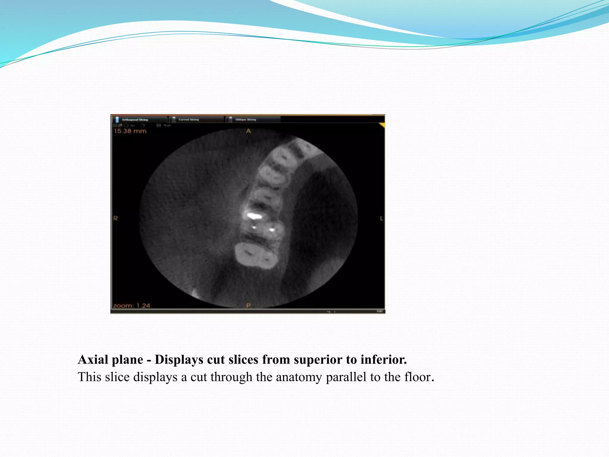 Cbct in endodontics ppt | PPTX