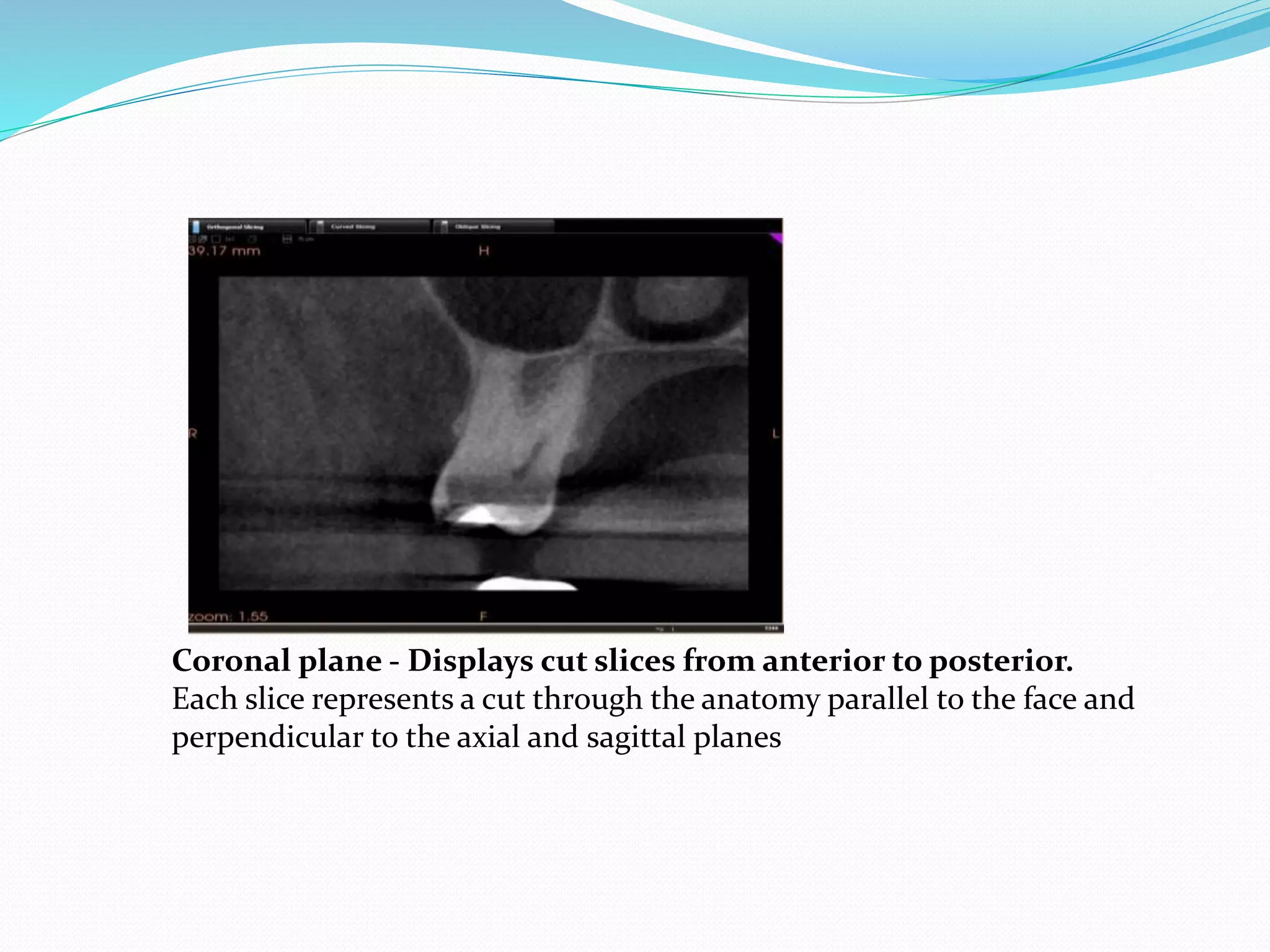 Cbct in endodontics ppt | PPTX