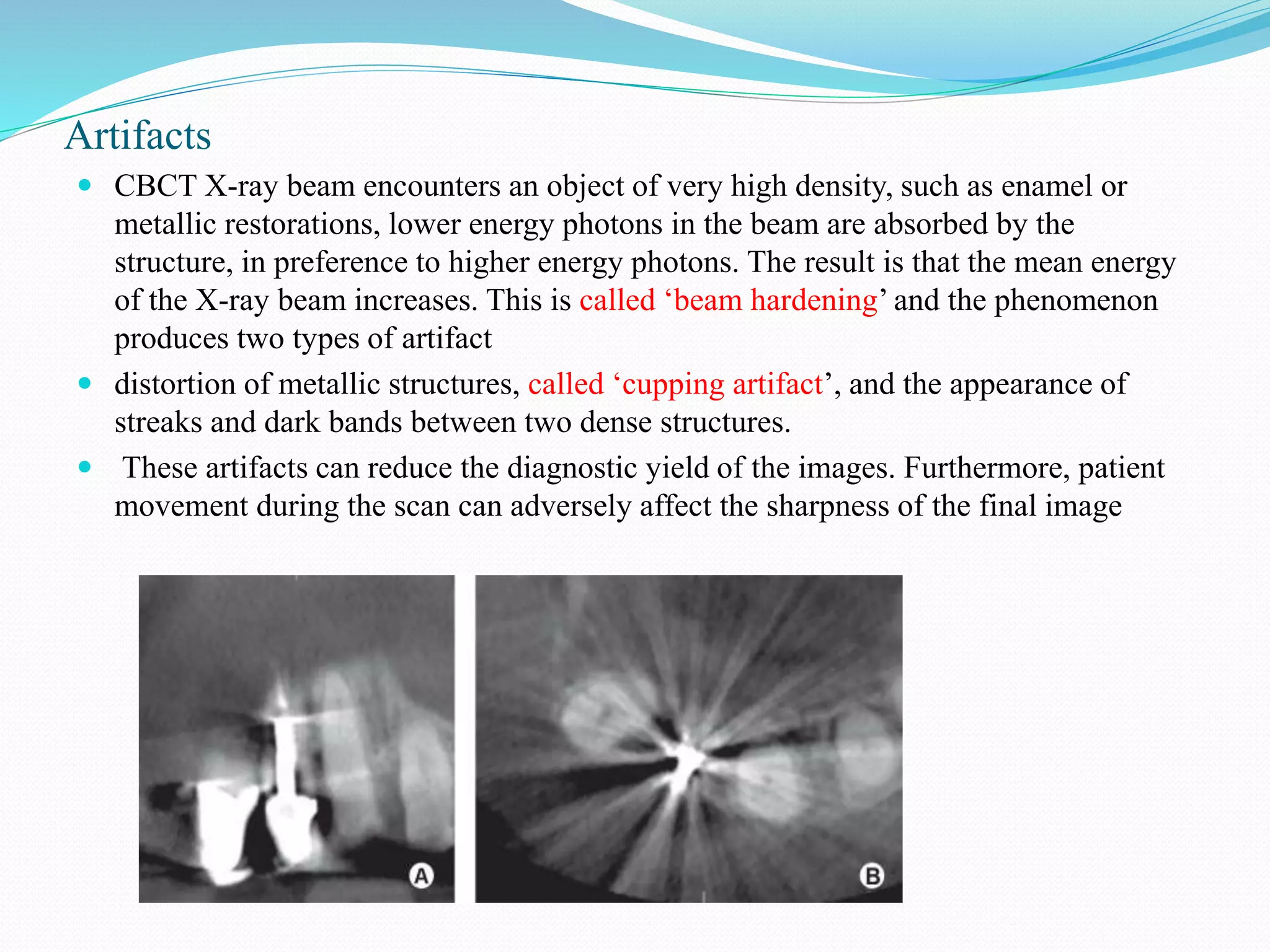 Cbct in endodontics ppt | PPT | Free Download