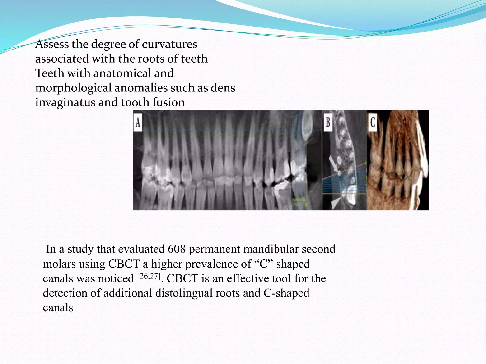 Cbct in endodontics ppt | PPTX