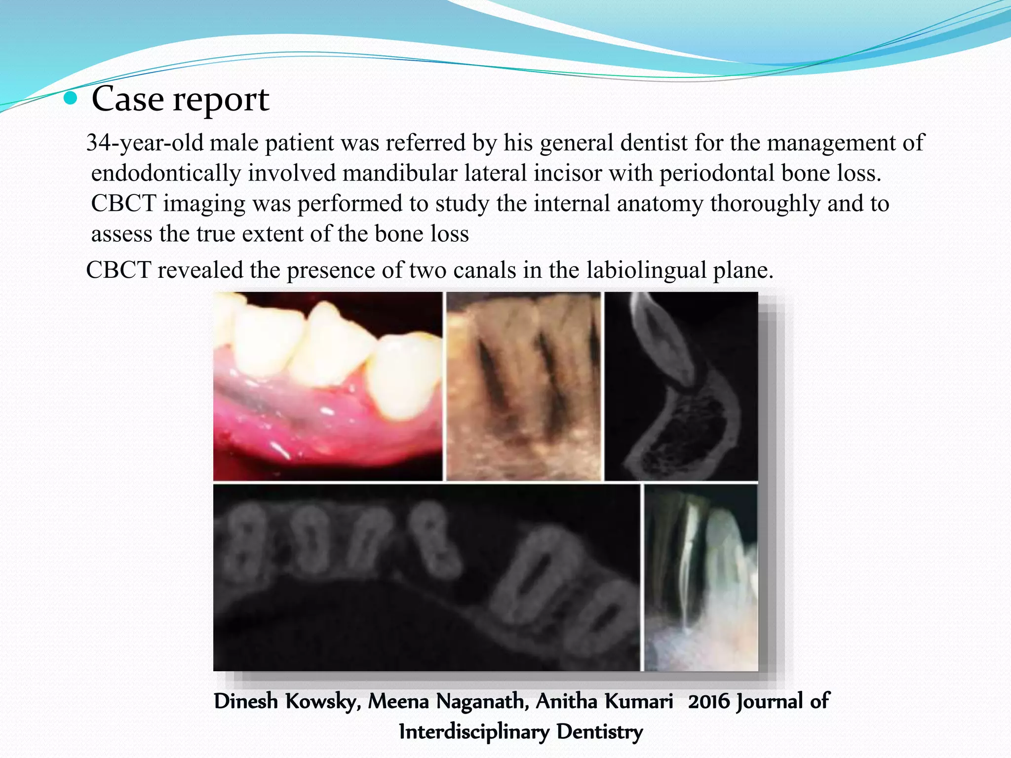 Cbct in endodontics ppt | PPTX