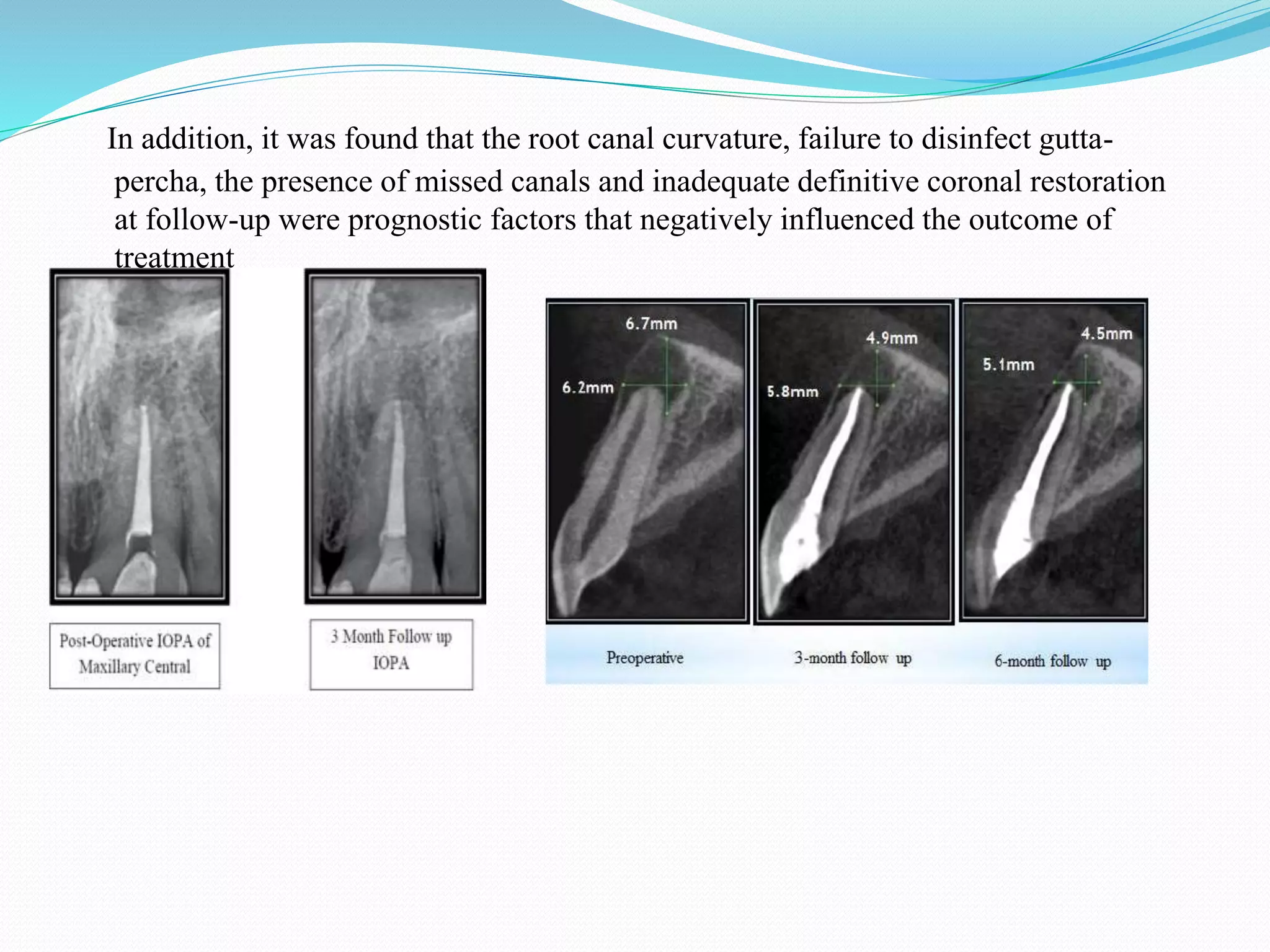 Cbct in endodontics ppt | PPTX