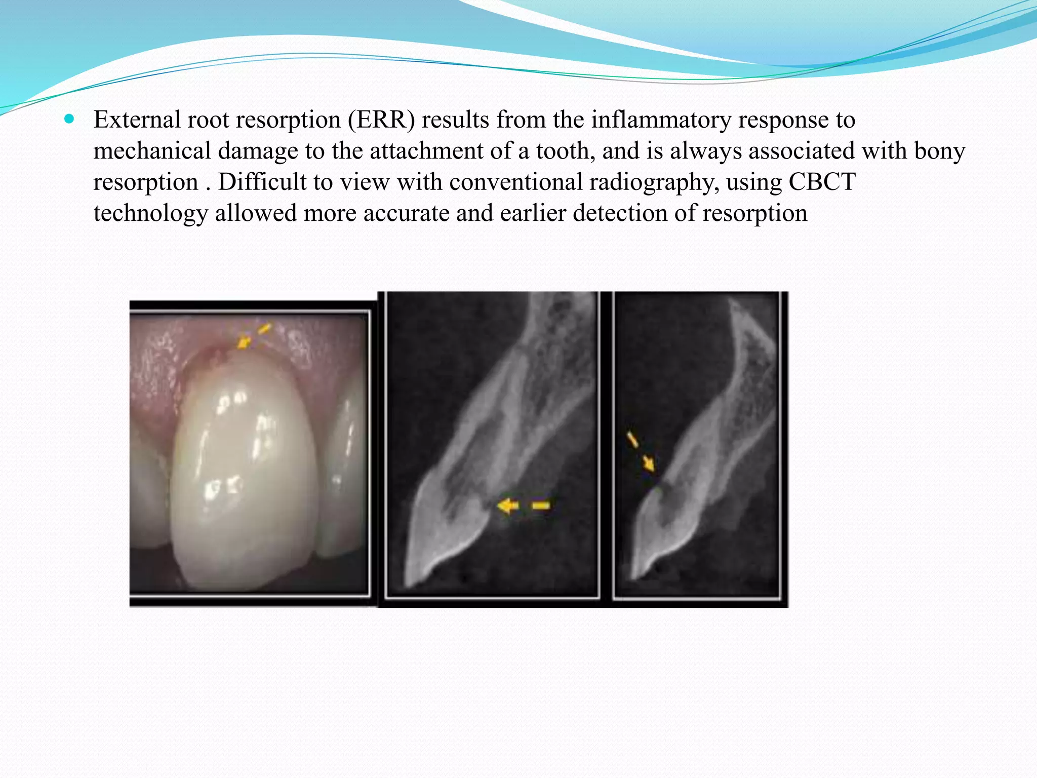 Cbct in endodontics ppt | PPTX