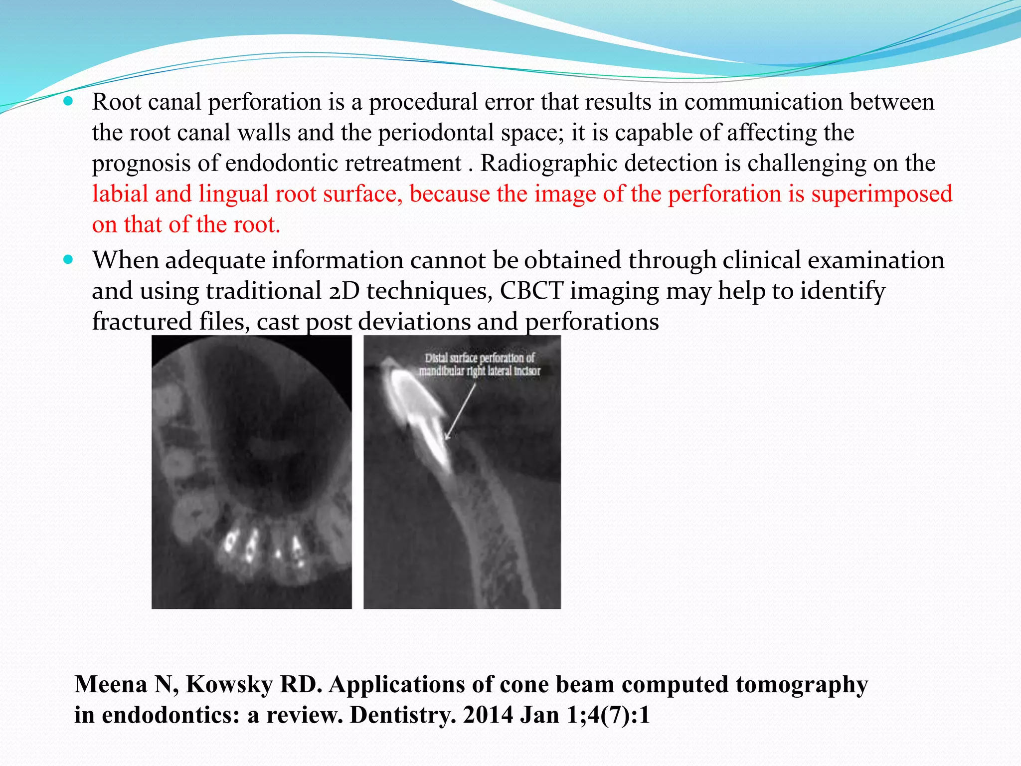 Cbct in endodontics ppt | PPTX