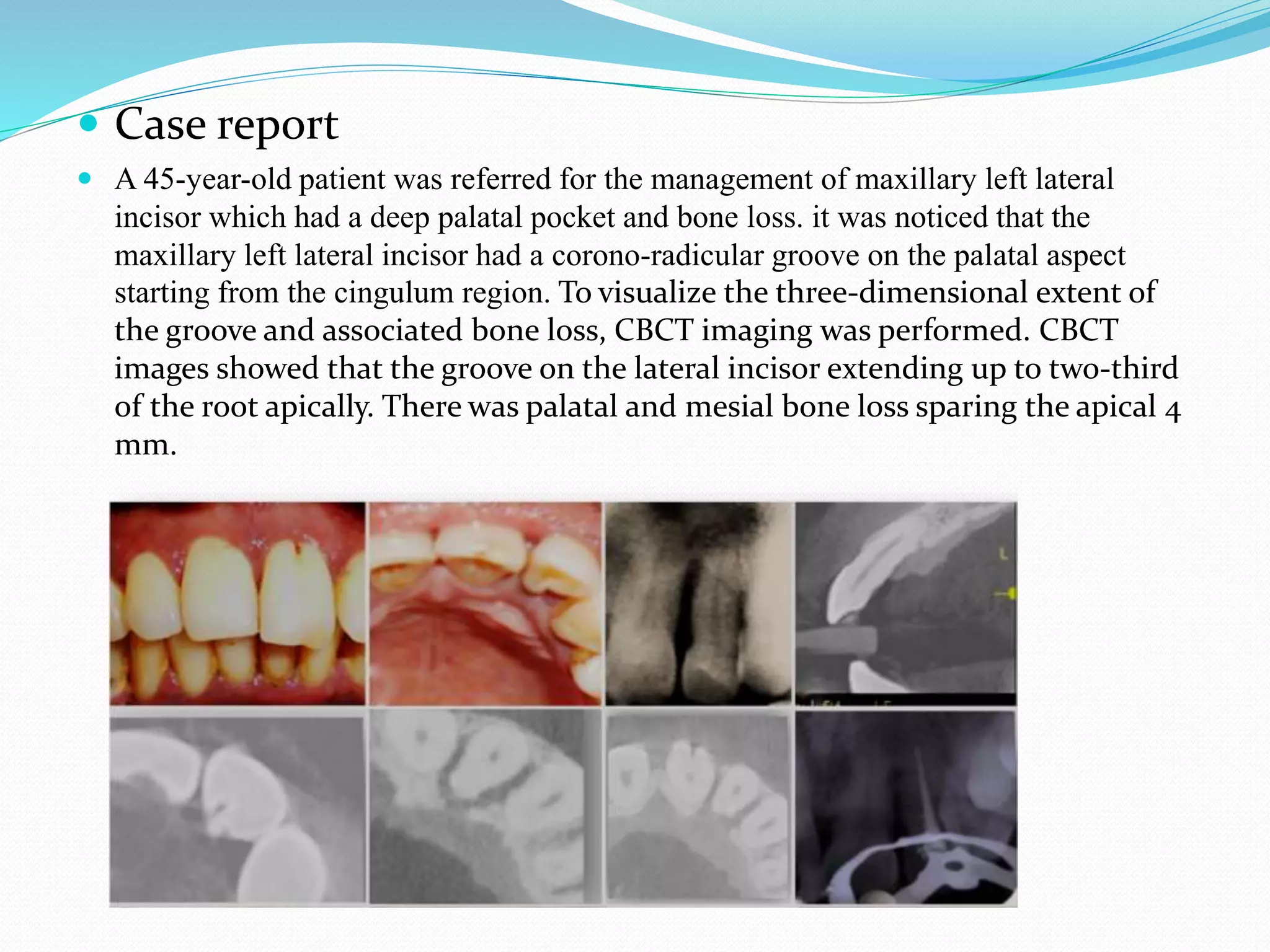 Cbct in endodontics ppt | PPTX