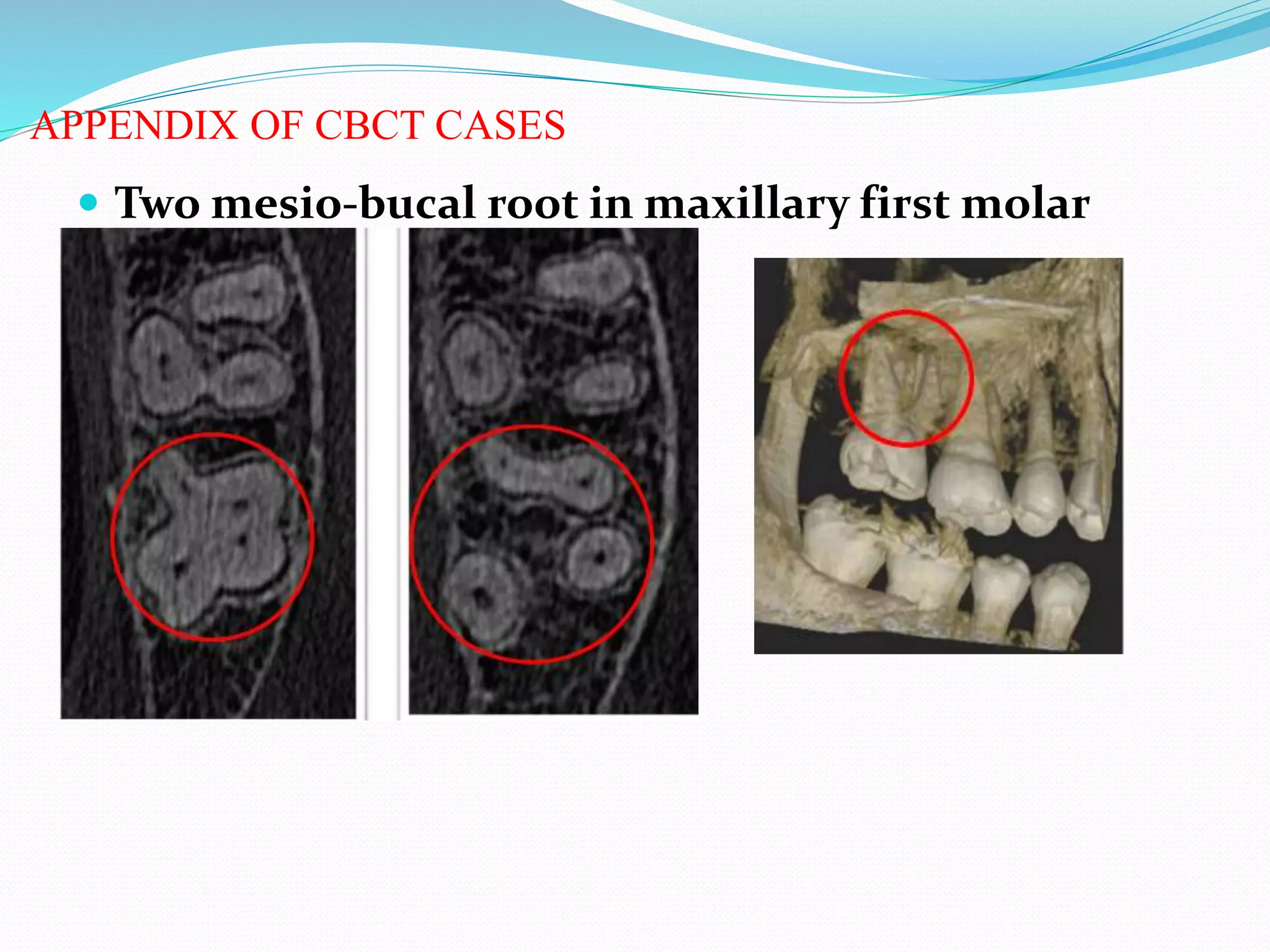 Cbct in endodontics ppt | PPTX
