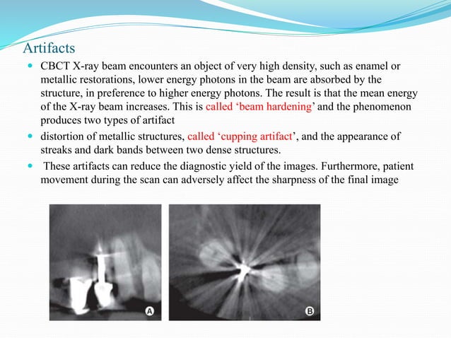 Cbct in endodontics ppt | PPTX