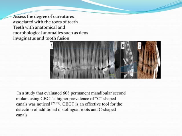 Cbct in endodontics ppt | PPTX