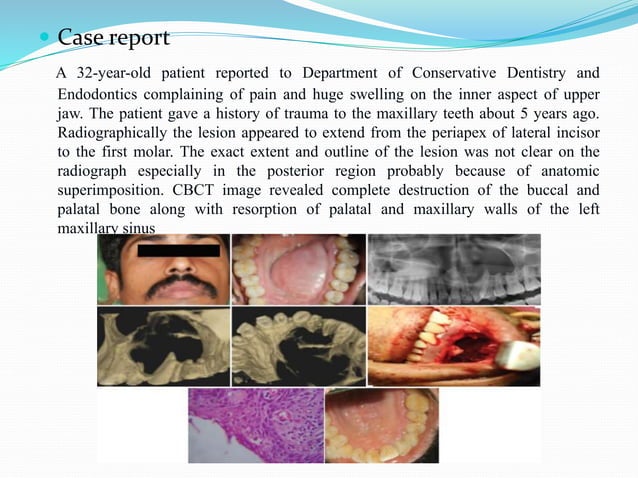 Cbct in endodontics ppt | PPTX