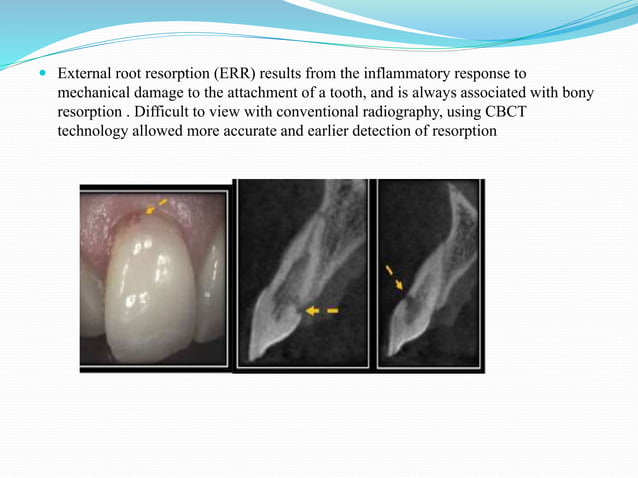 Cbct in endodontics ppt | PPTX