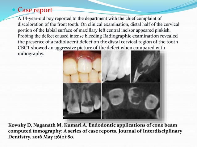 Cbct in endodontics ppt | PPTX