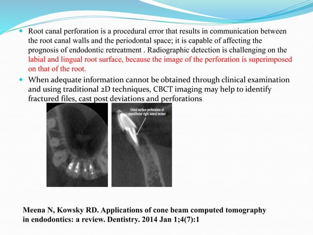 Cbct in endodontics ppt | PPTX