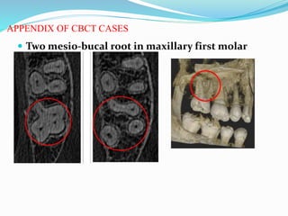 Cbct in endodontics ppt | PPTX
