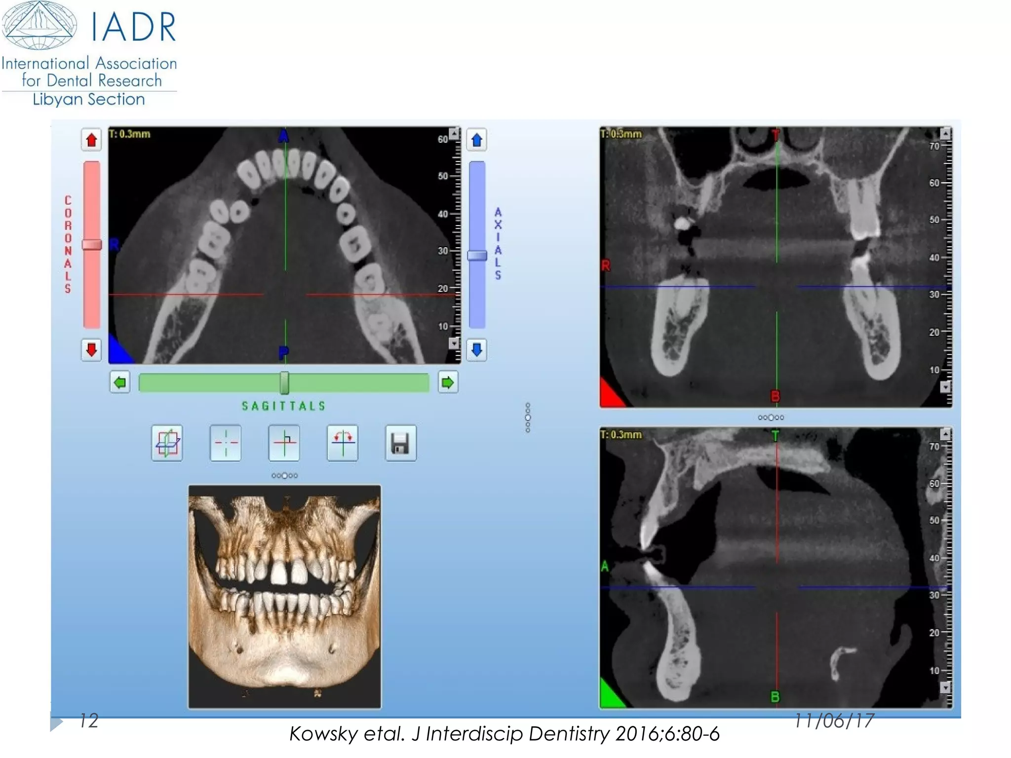 Use of Cone Beam Computed Tomography in Endodontics | PPT