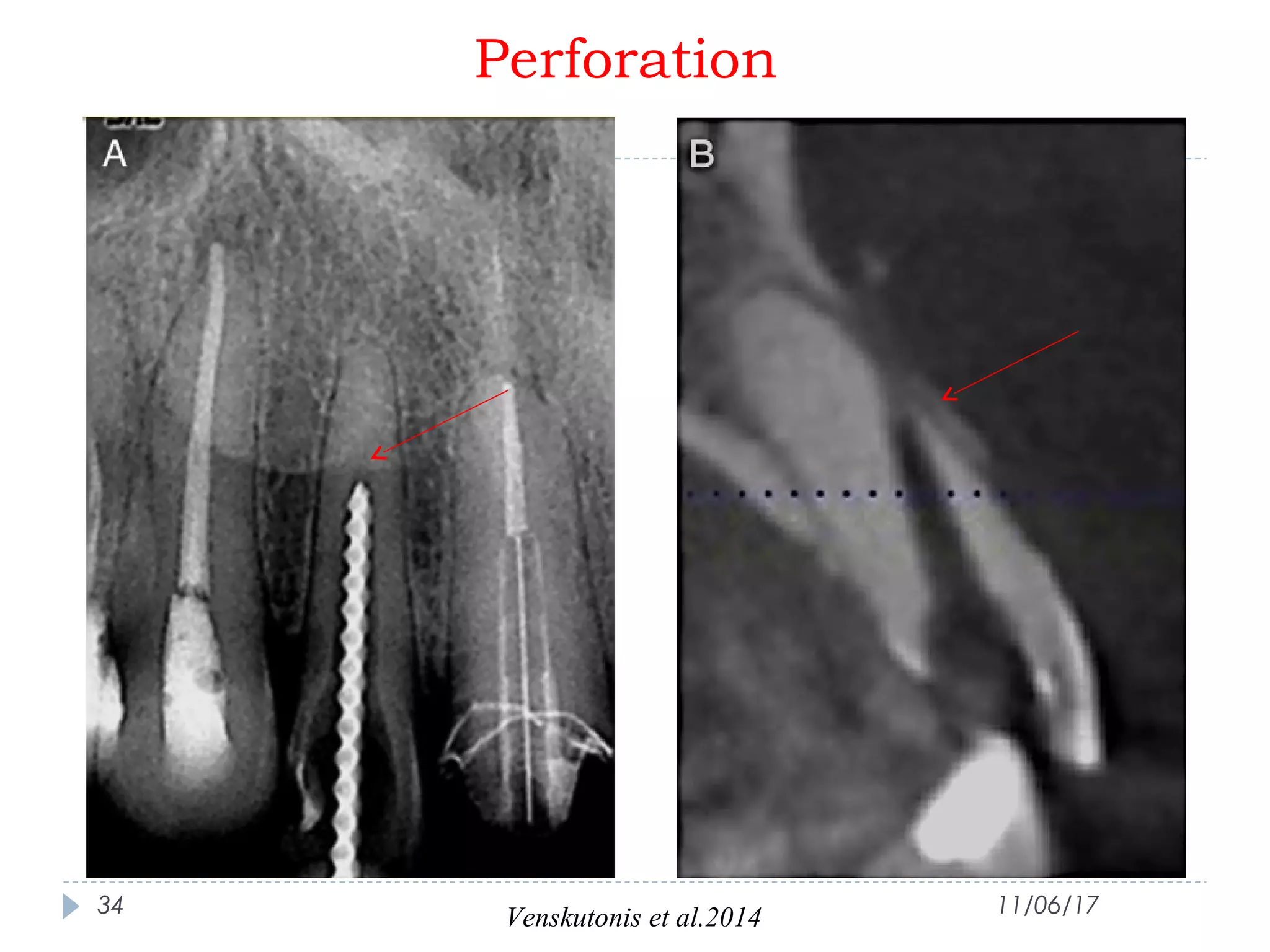 Use of Cone Beam Computed Tomography in Endodontics | PPT