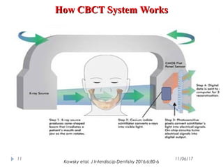Use of Cone Beam Computed Tomography in Endodontics | PPT