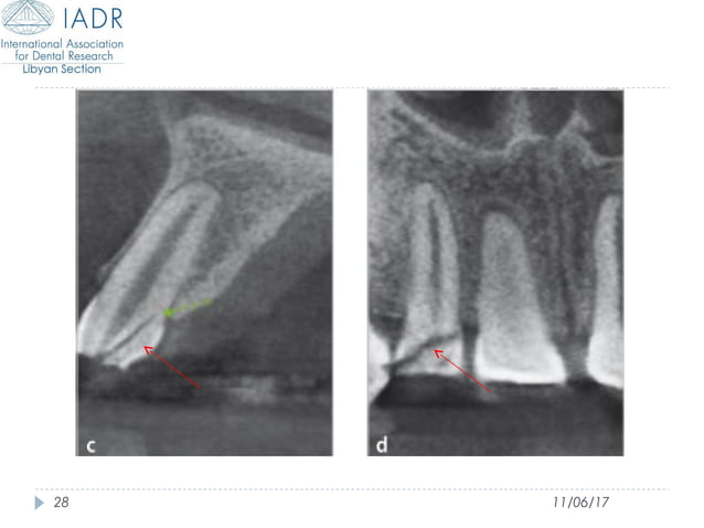 Use of Cone Beam Computed Tomography in Endodontics | PPT