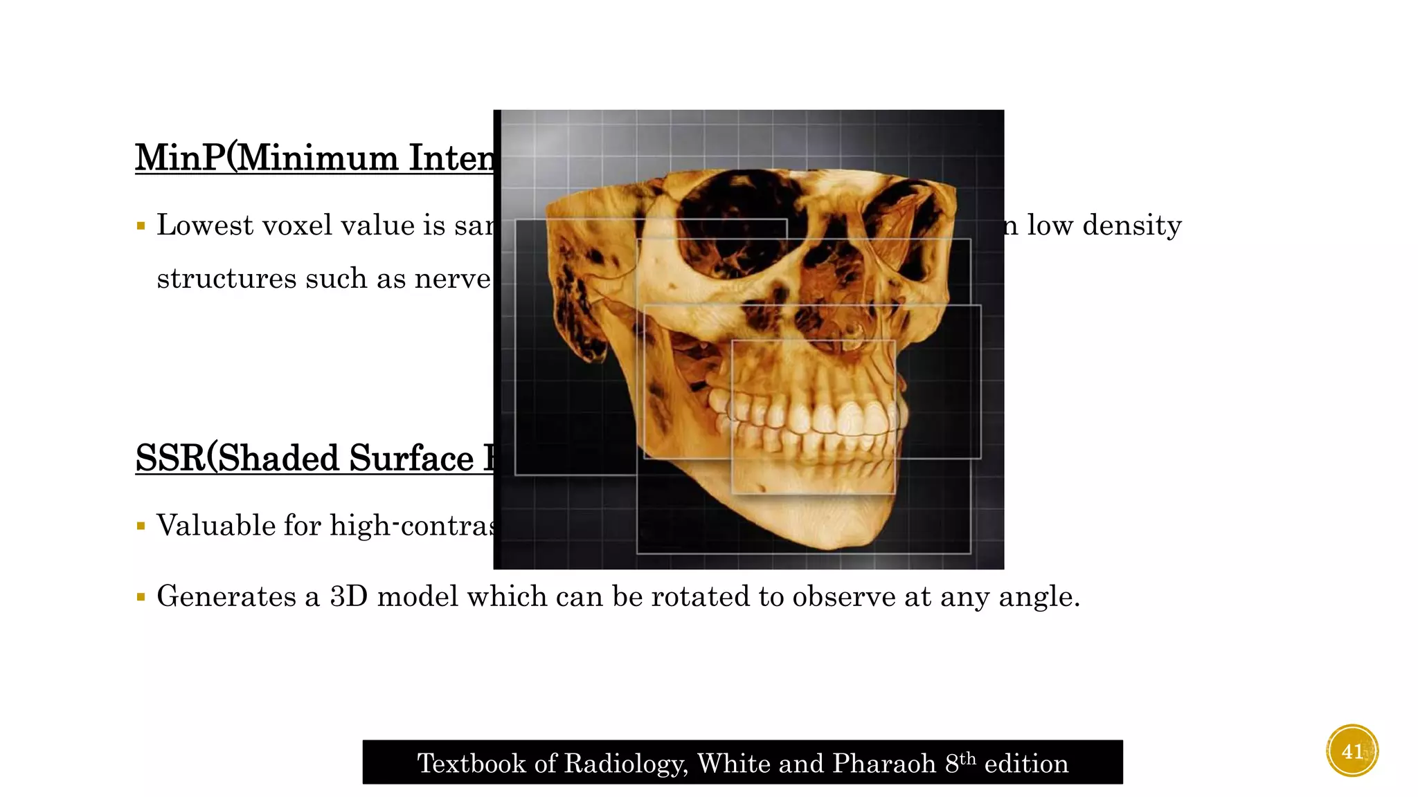 CBCT IN IMPLANTOLOGY.pptx