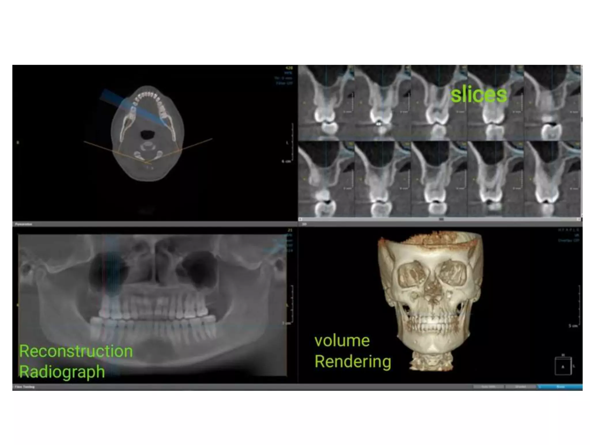 CBCT in Dentistry | PPTX