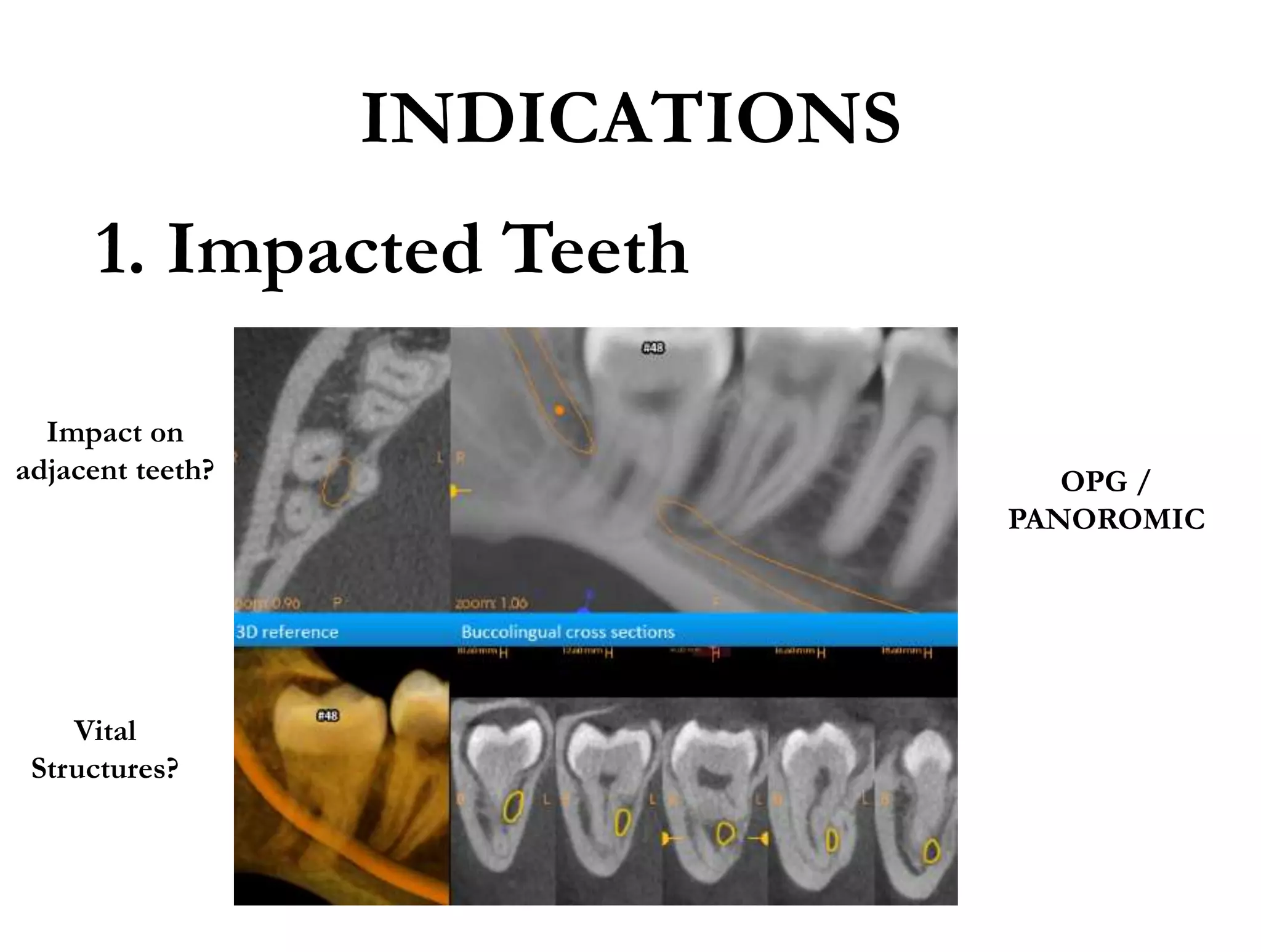CBCT in Dentistry | PPT