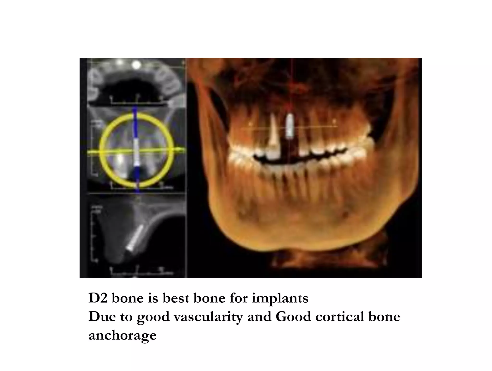 CBCT in Dentistry | PPT