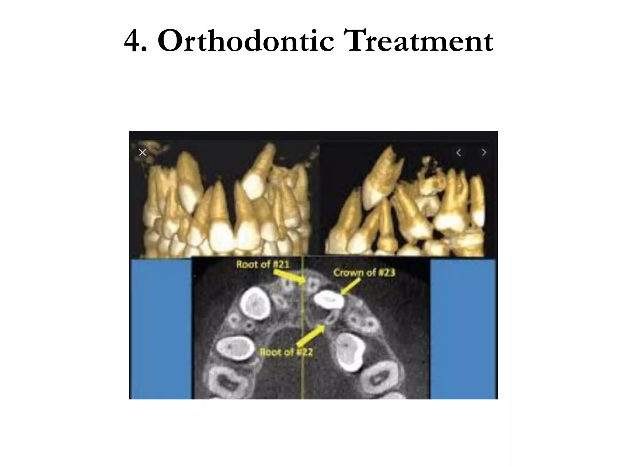 CBCT in Dentistry | PPT