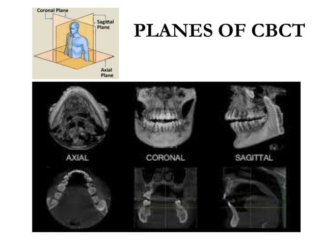 CBCT in Dentistry | PPTX
