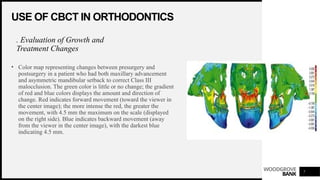 CBCT in ORTHODONTICS a comprehensive view | PPTX