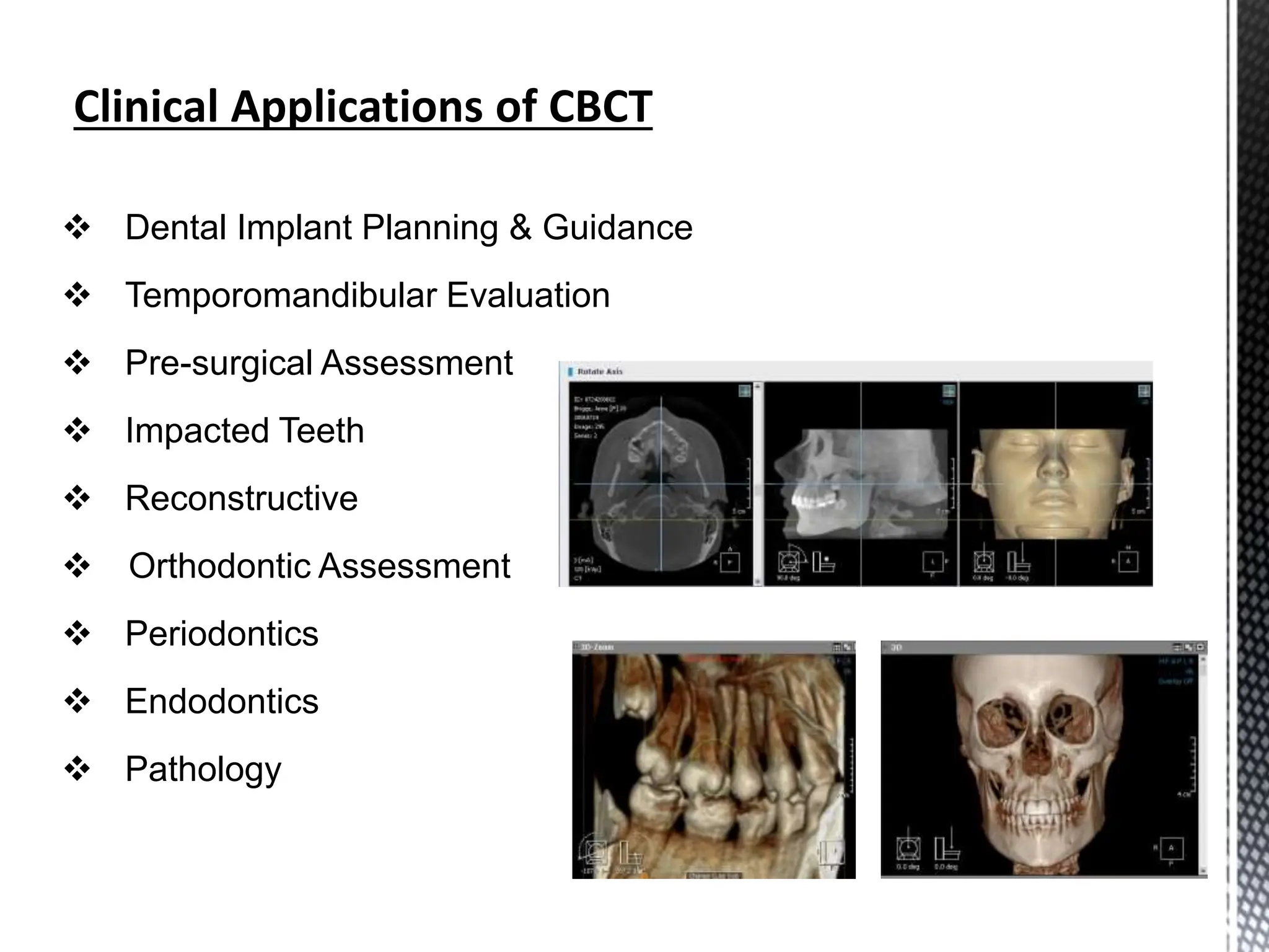 CBCT_INTERPRETATION CBCT APPLICATIONS & READING.pptx