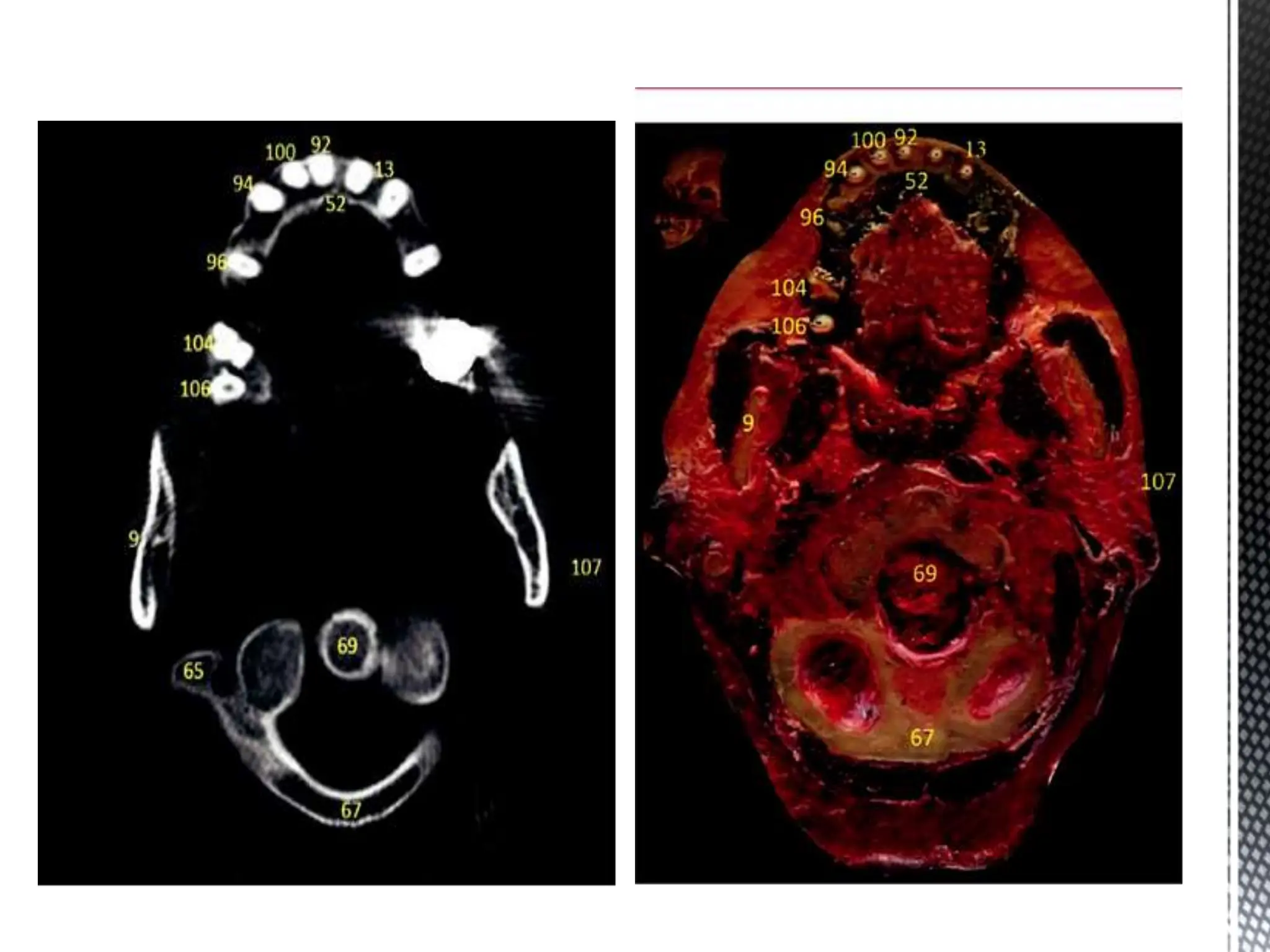 CBCT_INTERPRETATION CBCT APPLICATIONS & READING.pptx